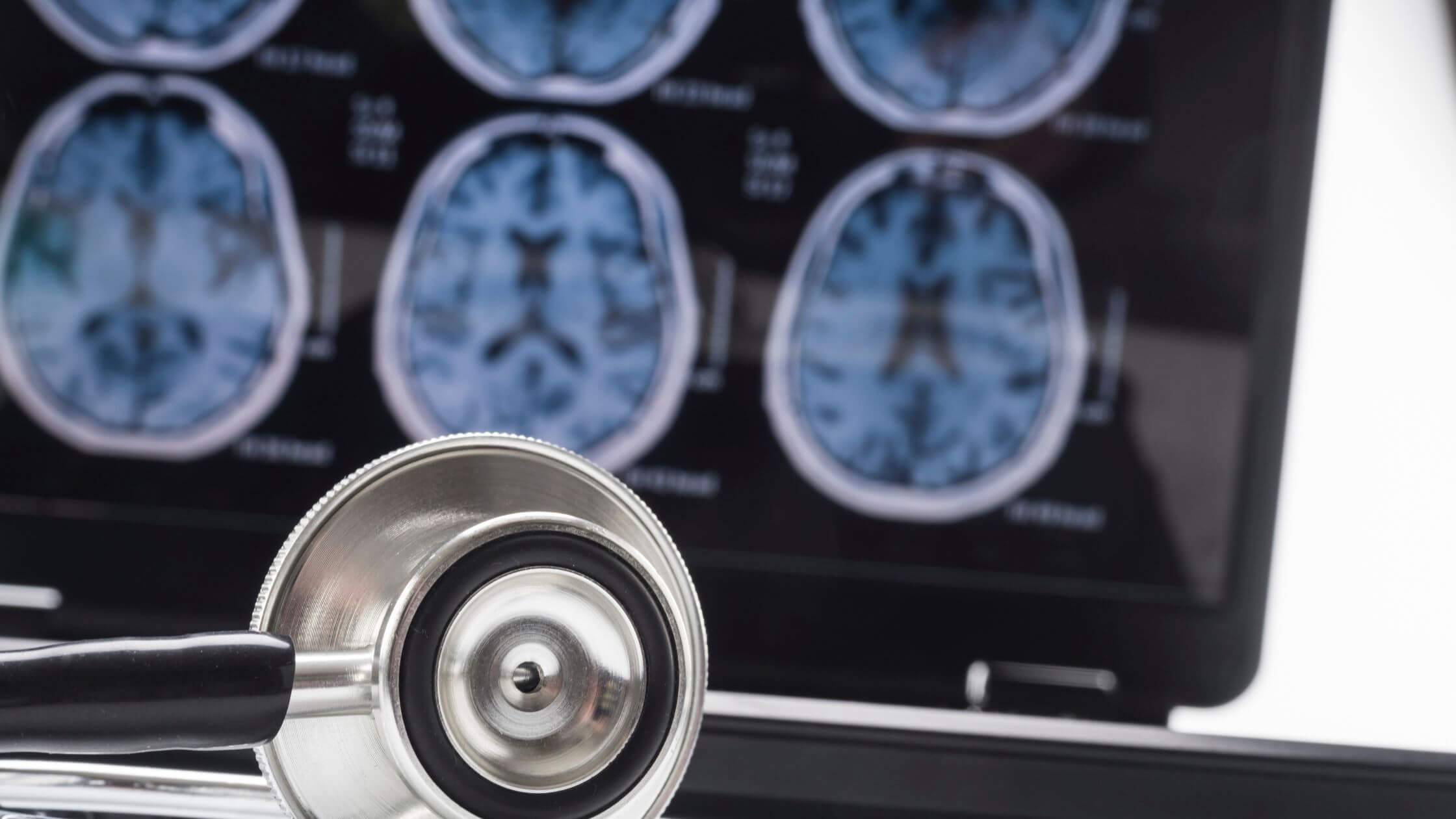 New clinical leadership to lead transformation in neuroscience – The ...